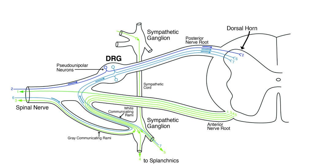 Radiculopathy Dorsal Root Ganglion